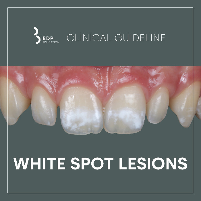 White Spot Lesions :: bdpeducation